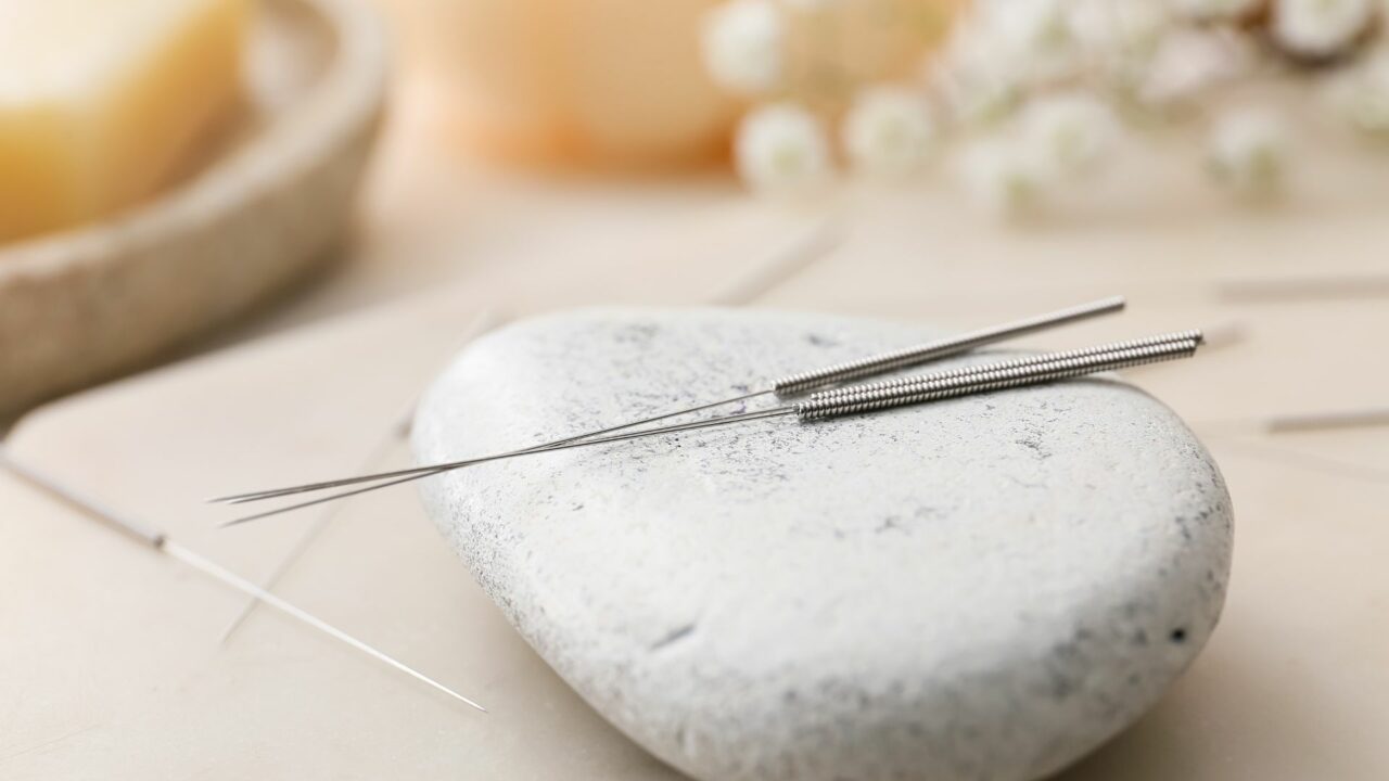 Acupuncture: An Effective Treatment for Back Pain