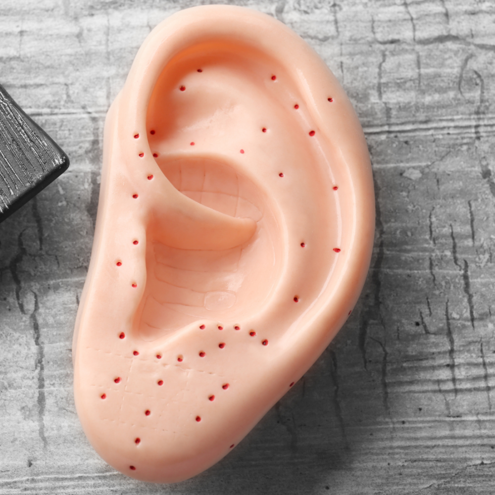 Ear Seed Therapy - Singapore Paincare TCM Wellness